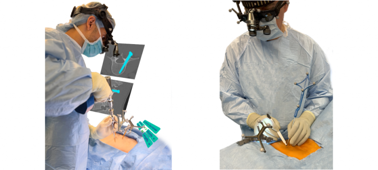 Homepage | OnPoint AR-AI